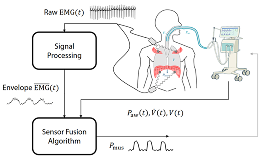 Biomedical Signal Processing & AI: Institute for Electrical Engineering ... Biomedical Signal Processing & AI: Institute for Electrical Engineering ...